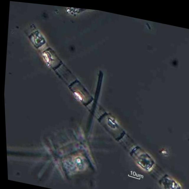 plankton-20 Object Detection Model (v2, 2025-05-06 7:54pm) by ...