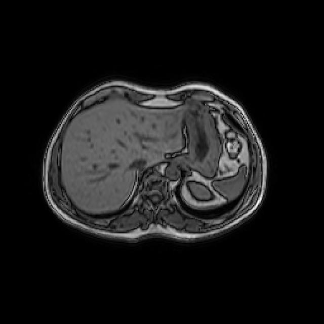 Liver Detection Object Detection Dataset and Pre-Trained Model by Reem