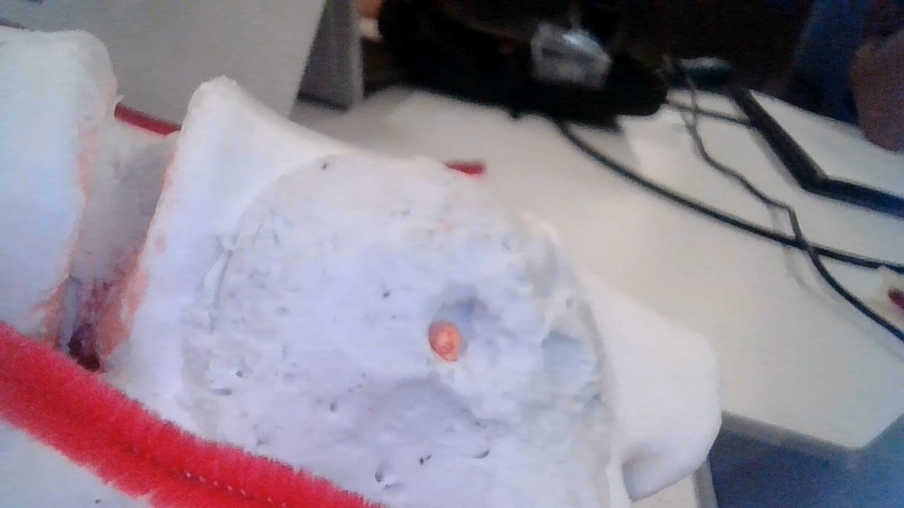 How to Use the Surgical Robot for tumors Instance Segmentation API