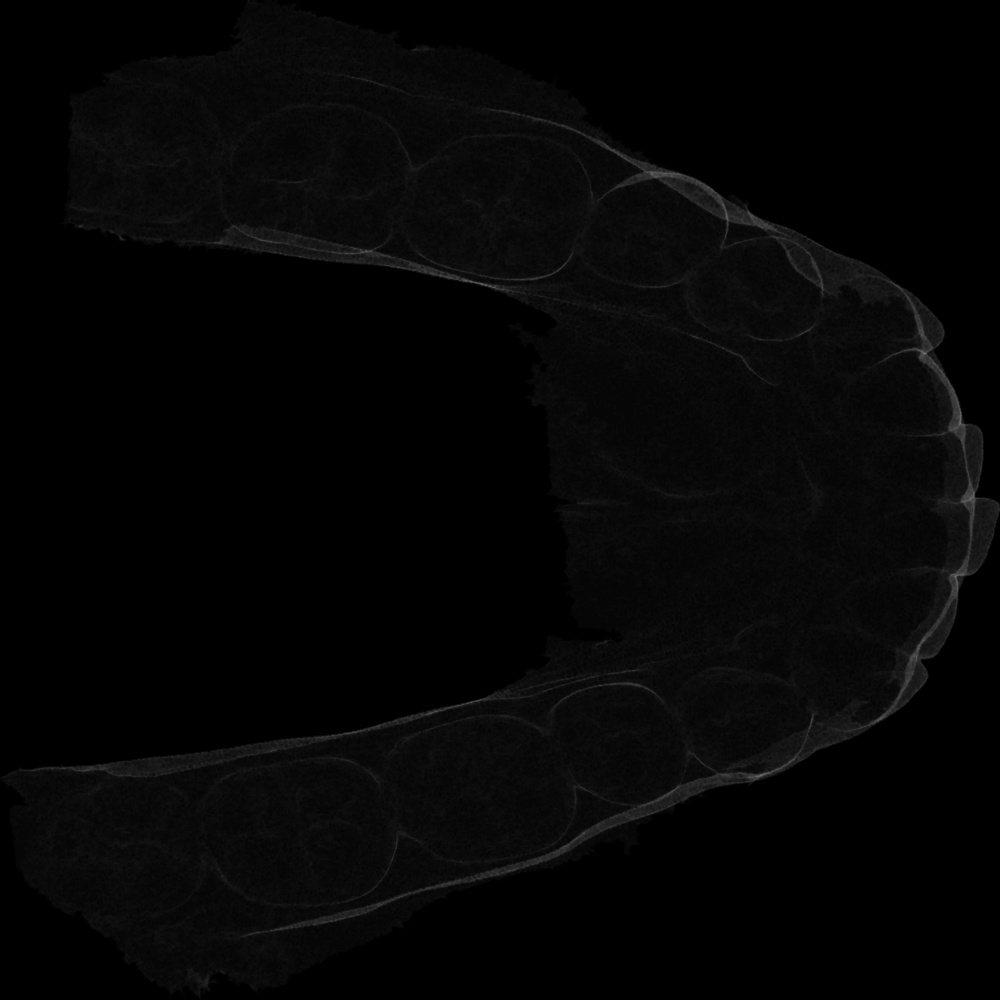 2d tooth segmentation pano (2d-tooth-segmentation-pano-tzzvf ...