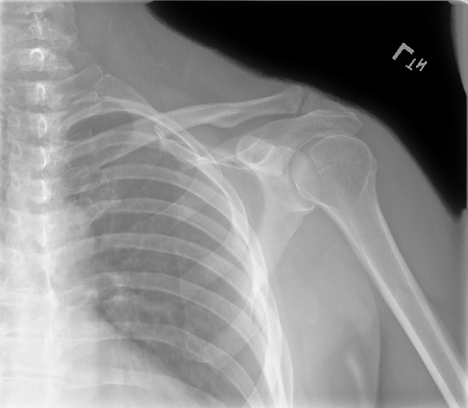 Surgical Robotic (surgical-robotic-tvonf) - Roboflow Universe