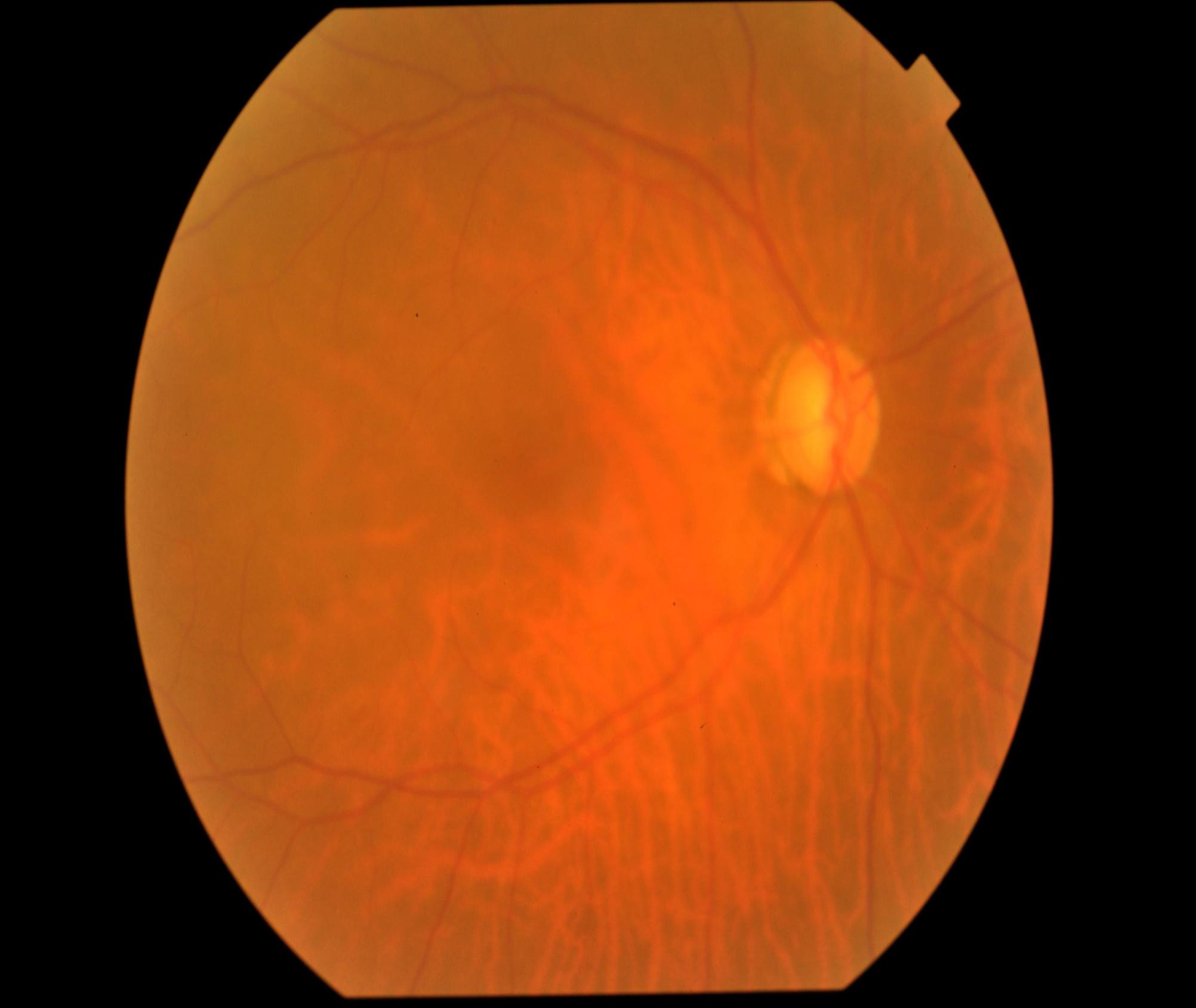 Eye diseases Classification Model by Asmaa