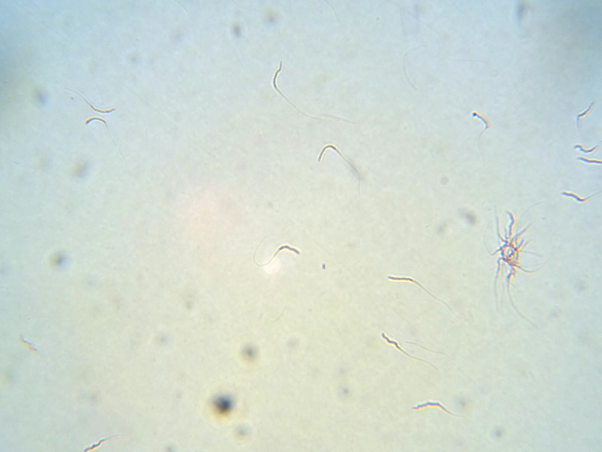 avian_sperm Object Detection Dataset and Pre-Trained Model by POSC681poultryimage