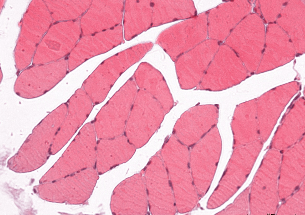 Tcc Object Detection Model By Maskr