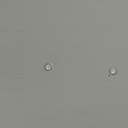 SCC Cell Detection Object Detection Dataset and Pre-Trained Model by Master Thesis