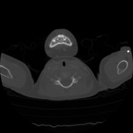 external_evaluation Instance Segmentation Dataset by ball