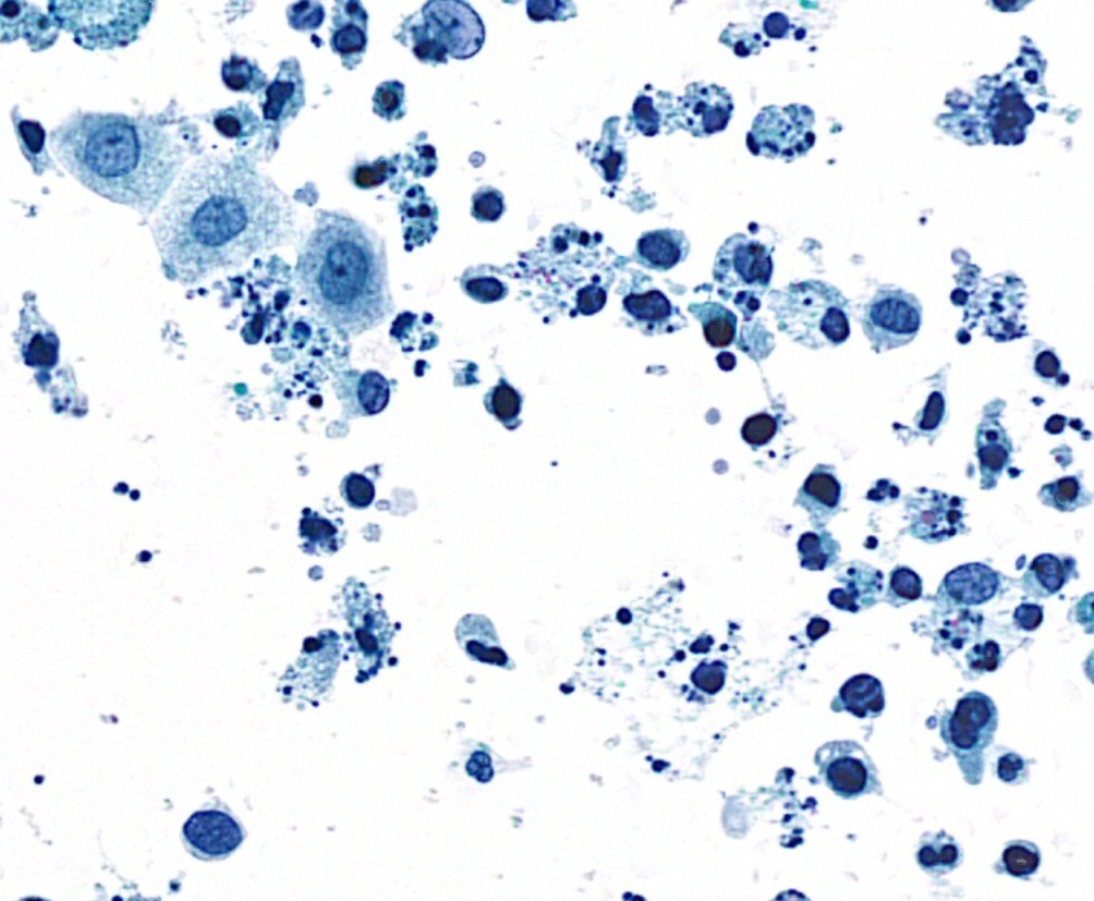 Urine Cytology image Object Detection Dataset by christine
