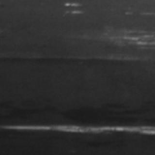 metal surface defects Object Detection Model by FYP