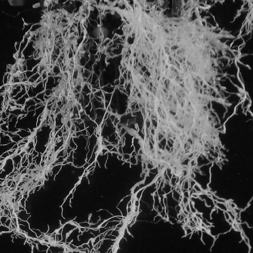 RKN detection - Roboflow Universe