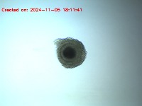 Top Oocyte Datasets and Models | Roboflow Universe