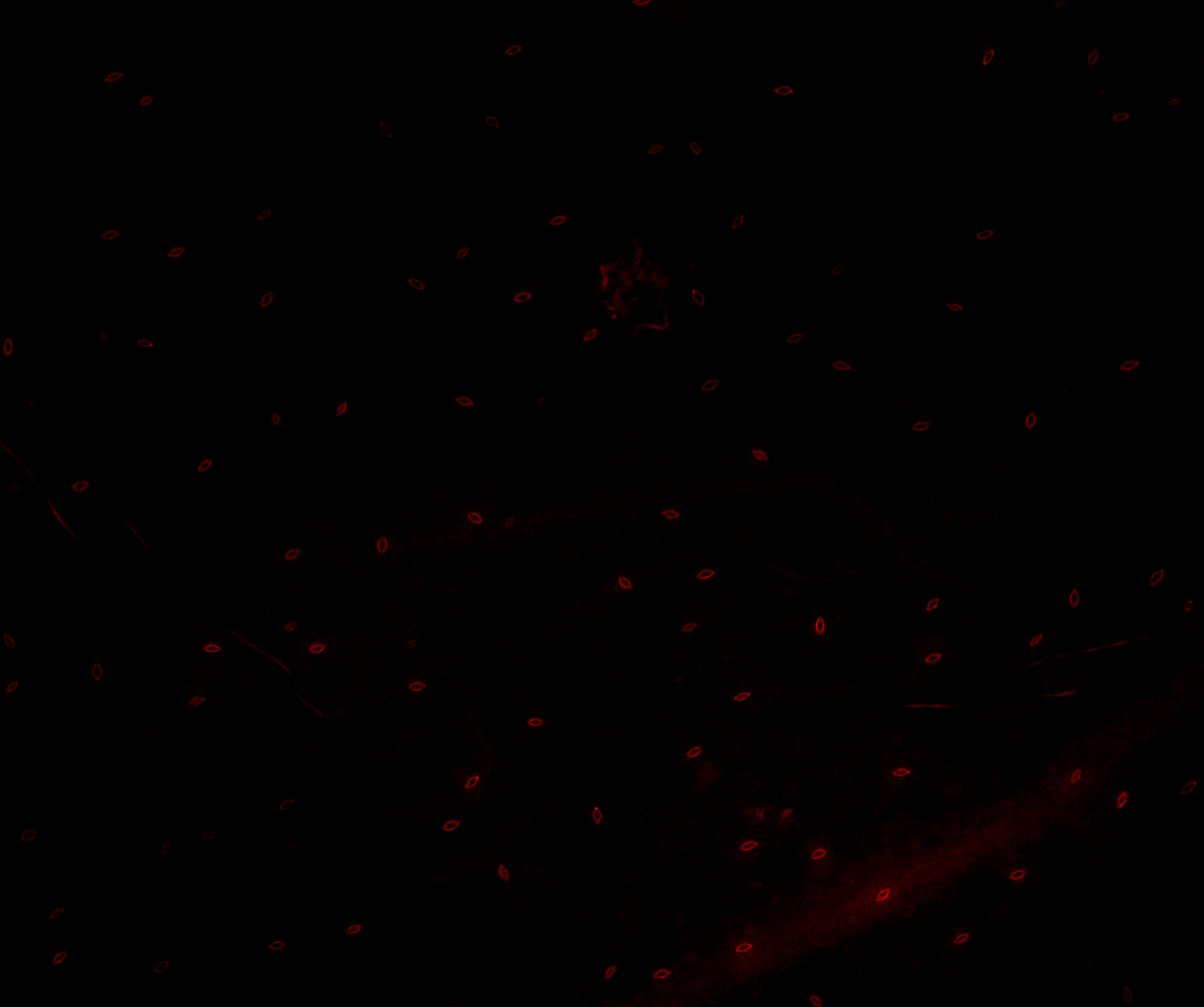 How to Use the Arabidopsis Stomata Roboflow AI Object Detection API