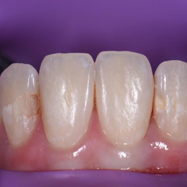 Big-cavity Object Detection Dataset and Pre-Trained Model by Mahos