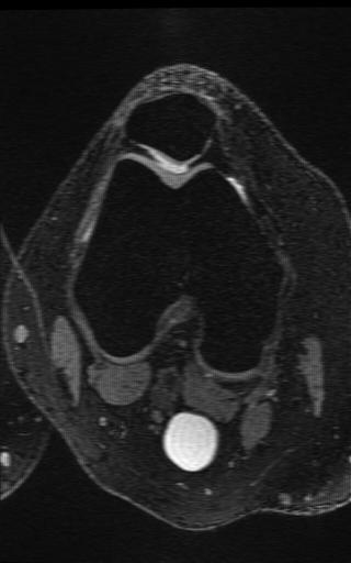 skm-mri Object Detection Dataset by TYP