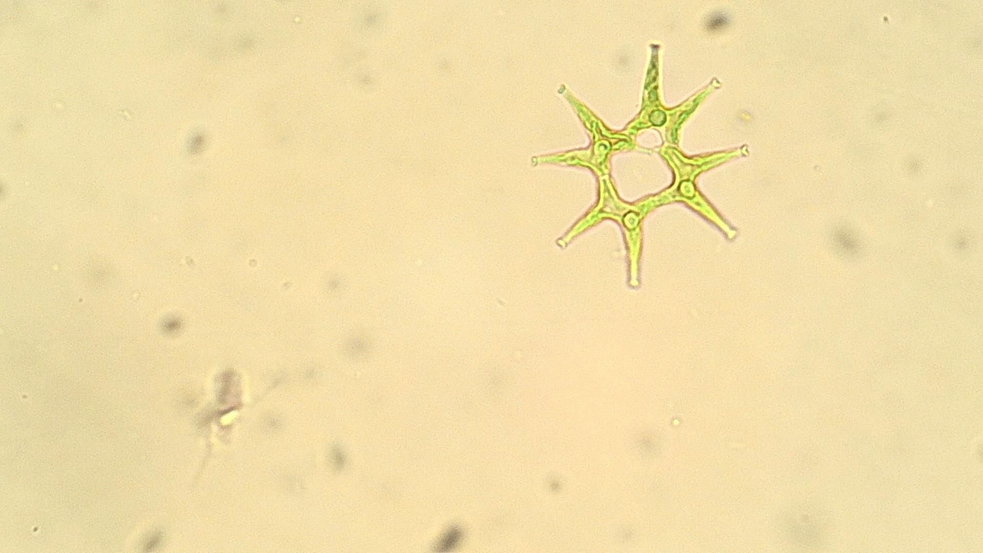 algea Instance Segmentation Model by yolo v8