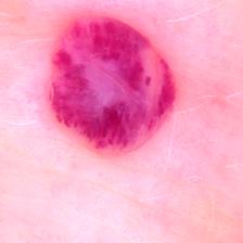 Skin Disease Classification Dataset by nagesh