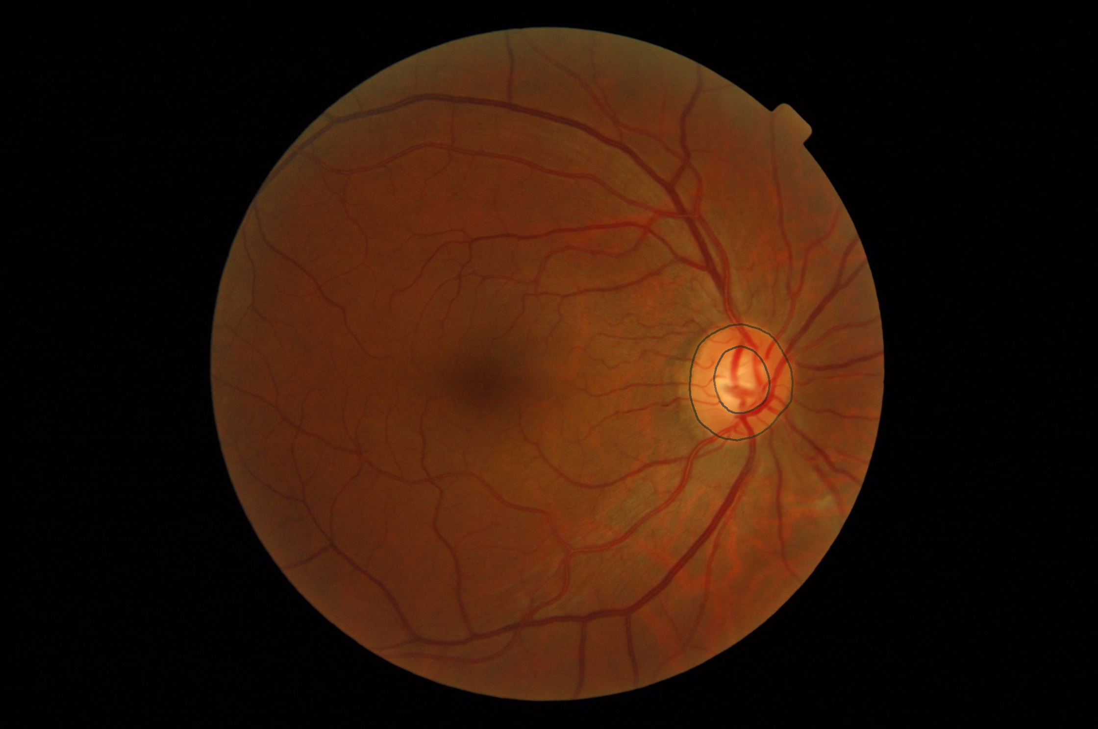 Helei - Roboflow Universe