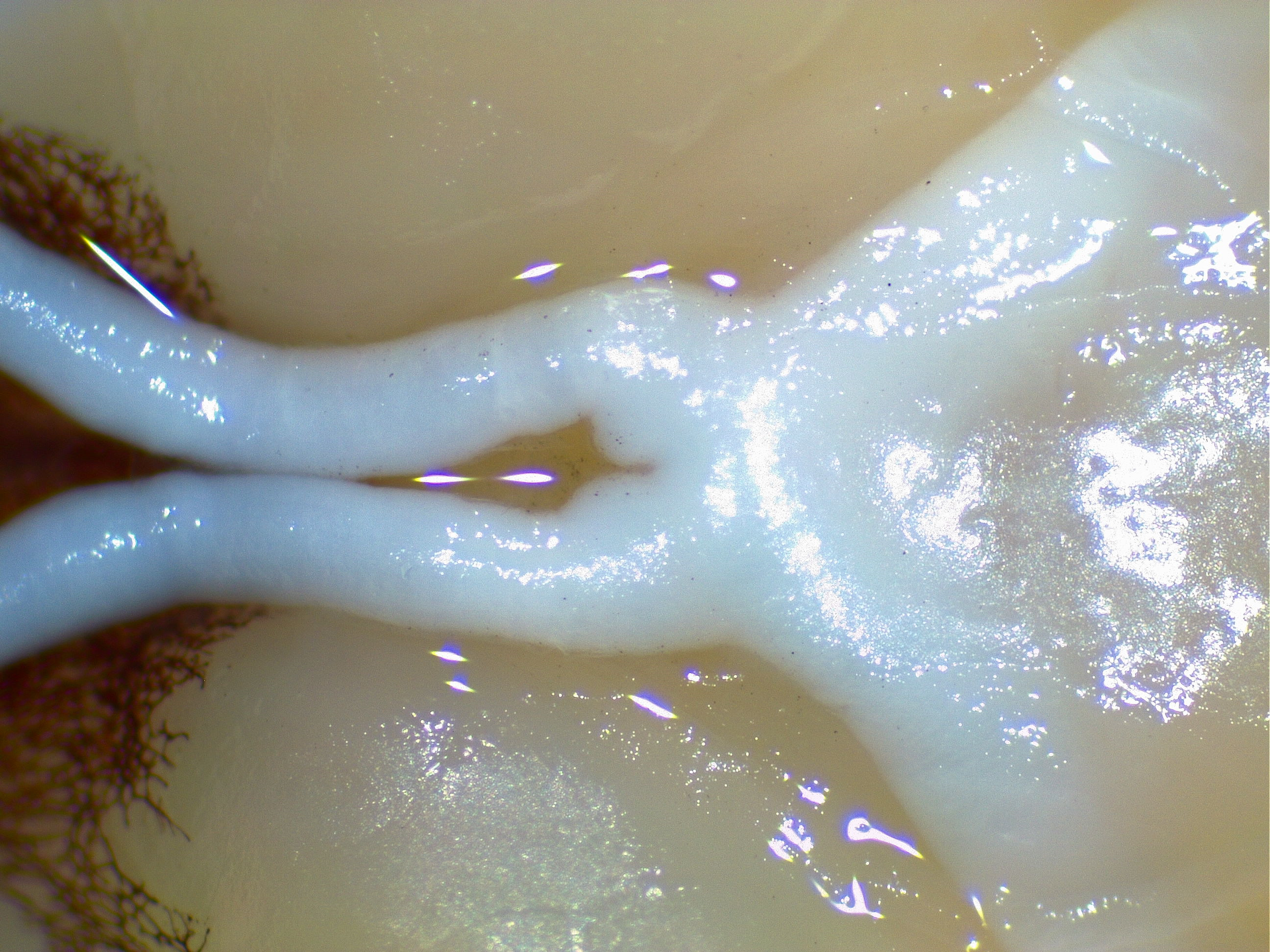 Mouse Optic Nerve Instance Segmentation Model by Research