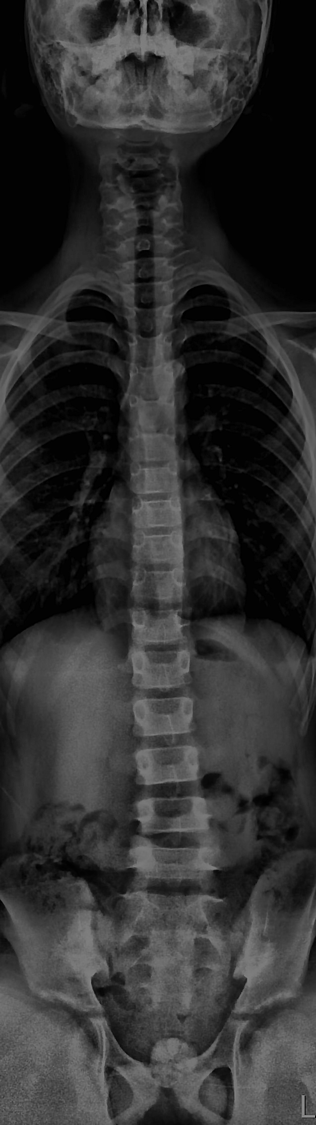 Gabriele Midulla - Roboflow Universe