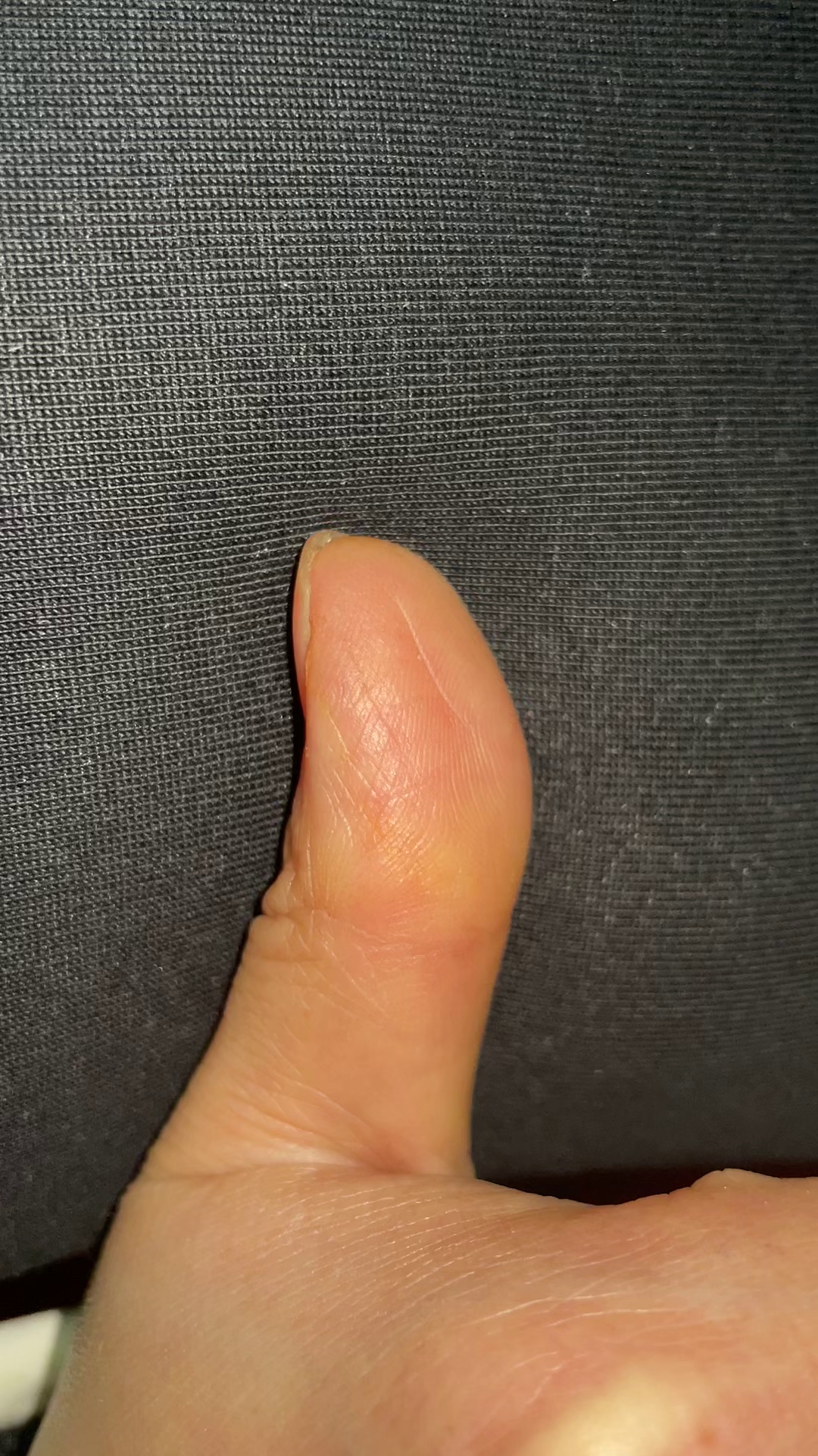 finger phalange detection Object Detection Dataset by 董成栋