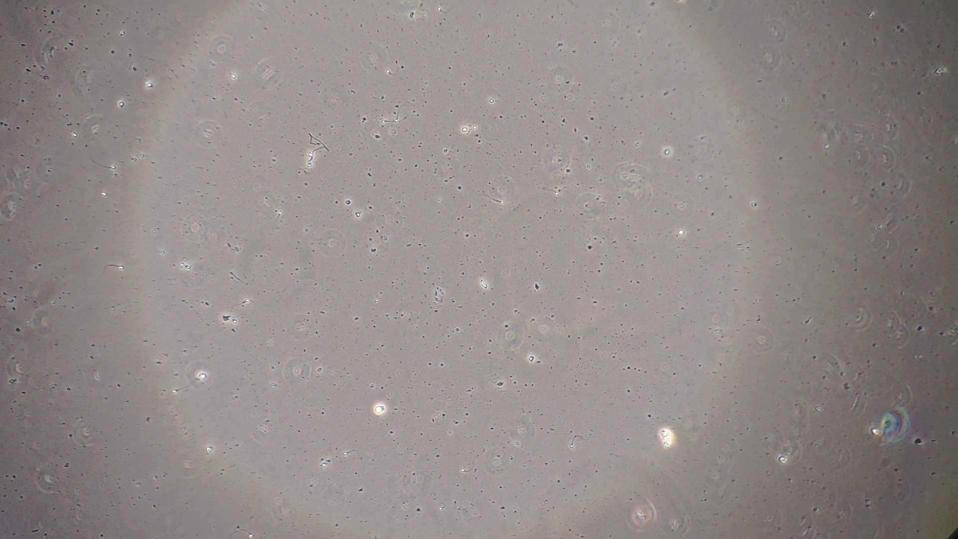 Sperm Dedecter Object Detection Dataset and Pre-Trained Model by Sperm Dedecter