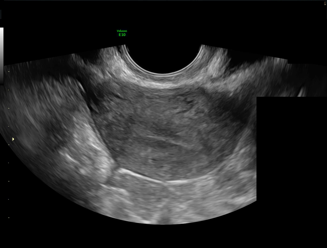 EMJ instance segmentation Instance Segmentation Dataset and Pre-Trained Model by Project