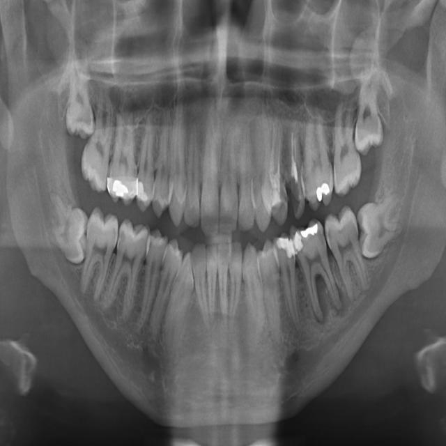 1 (1-c2i6a) - Roboflow Universe