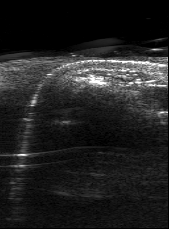 BTP_Bone Semantic Segmentation Dataset by IIT PKD