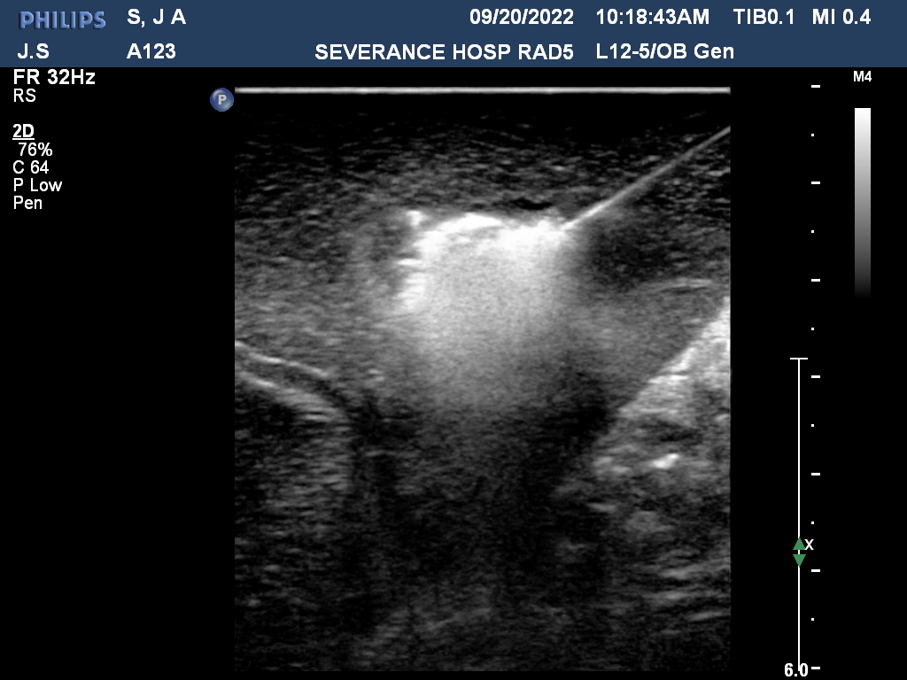 Ex Labeling Instance Segmentation Dataset By Lesionsegmentation