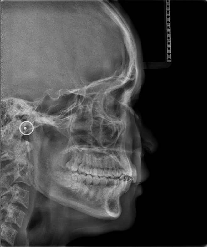 Landmark Detection Object Detection Dataset by Landmark Detection