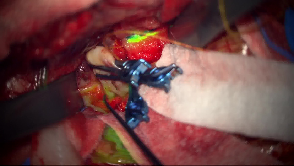 SAM2 clip Object Detection Dataset and Pre-Trained Model by SIMI Research