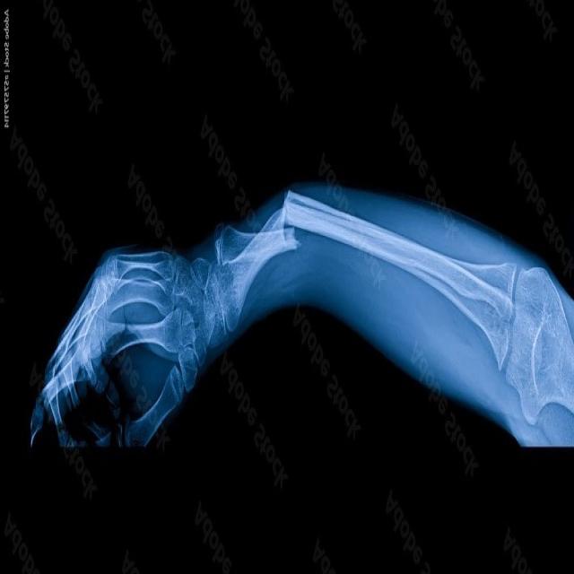 Practica Ii Modulo V Object Detection Dataset By Modulo V Prctica 2