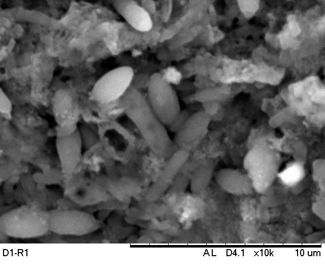 Microbes Instance Segmentation Dataset by Capstone 1