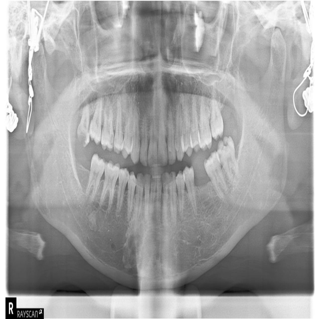 zkzk - Roboflow Universe