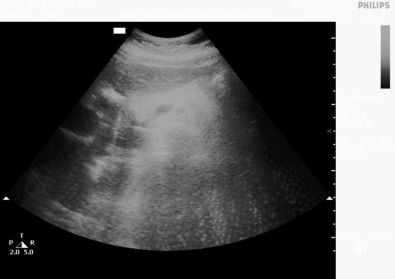 USG Annotations - Roboflow Universe