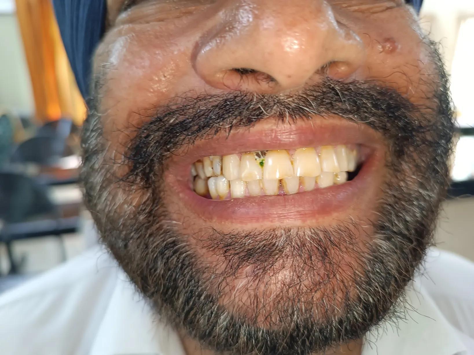 View_dent Object Detection Dataset and Pre-Trained Model by Arshs ...