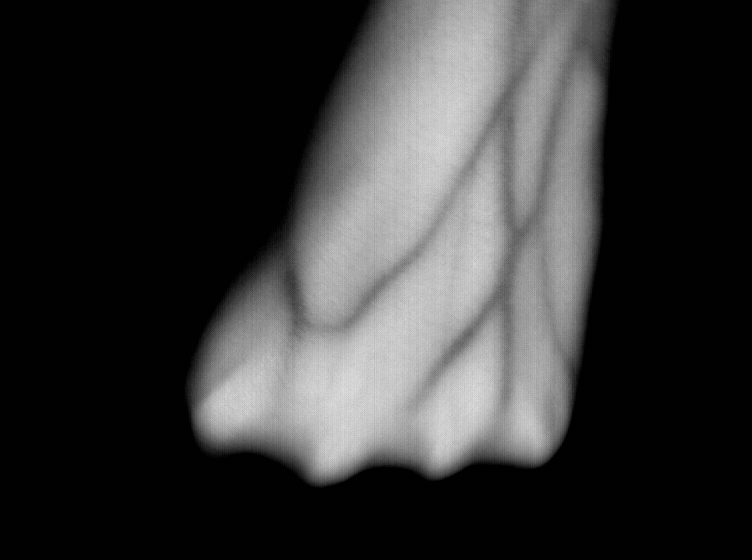 Vein Instance Segmentation Dataset by Vein
