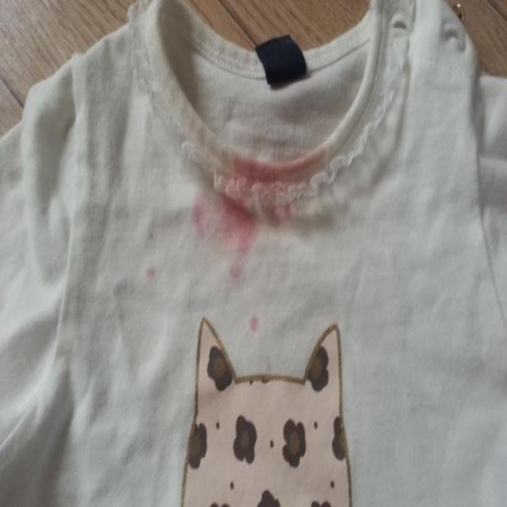 t-shirt defects Instance Segmentation Model by Aaron Alonso