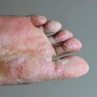 fungal annotations - Roboflow Universe