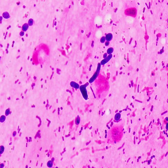 yeast Object Detection Dataset by kdicons