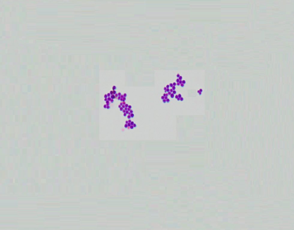 staphylococcus3_bk Object Detection Dataset by kdicons