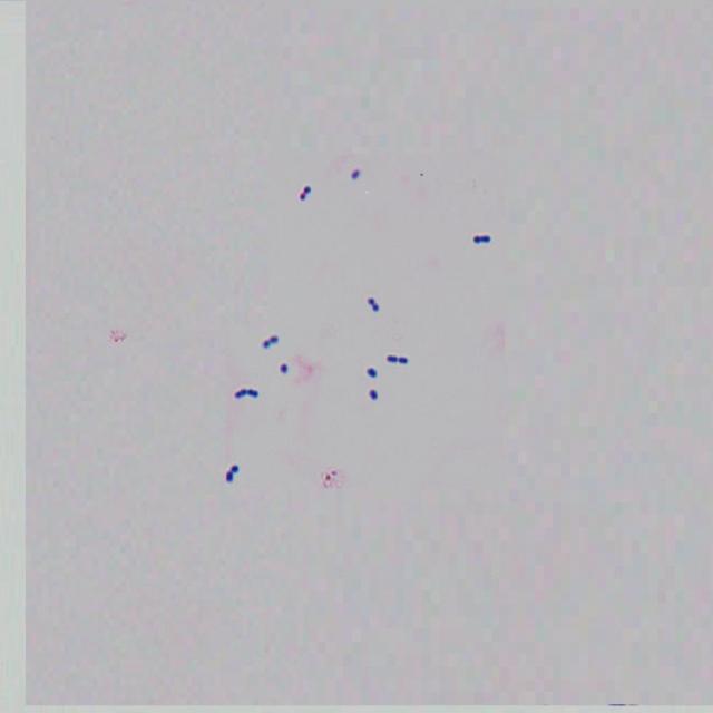 Enterococcus Object Detection Dataset By Kdicons