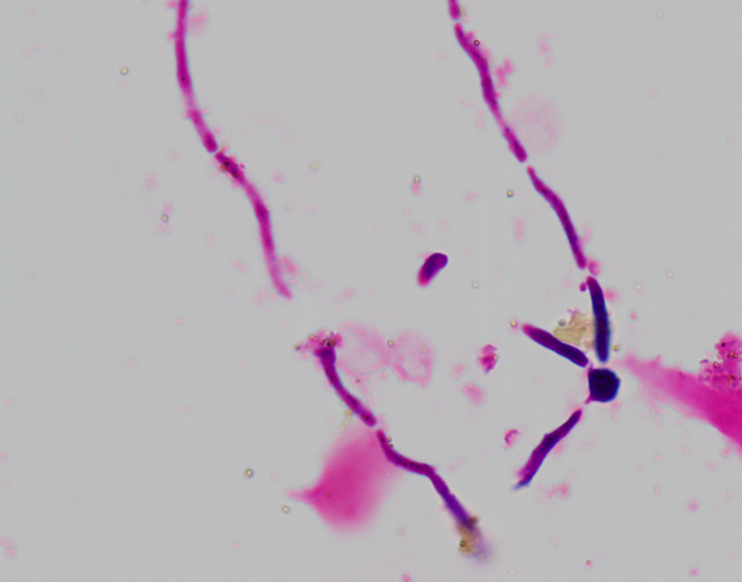 yeast Object Detection Dataset by kdicons