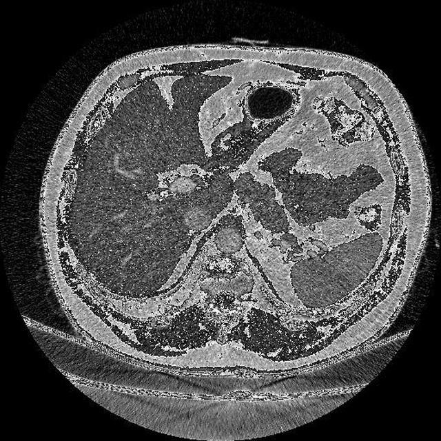 doni Instance Segmentation Dataset by doni
