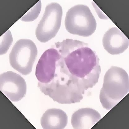 IDENTIFY BLOOD CELL Object Detection Dataset and Pre-Trained Model by ...