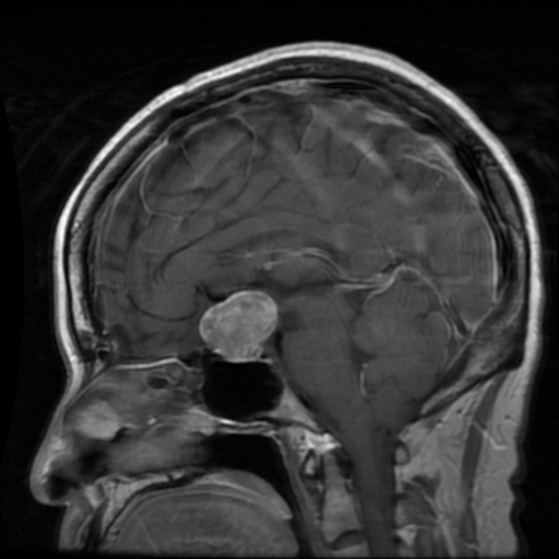 SegmentationBrainFig Object Detection Dataset by FYP