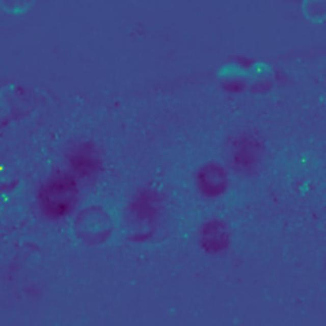 Particle Tracking Object Detection Dataset And Pre Trained Model By Particle Tracking