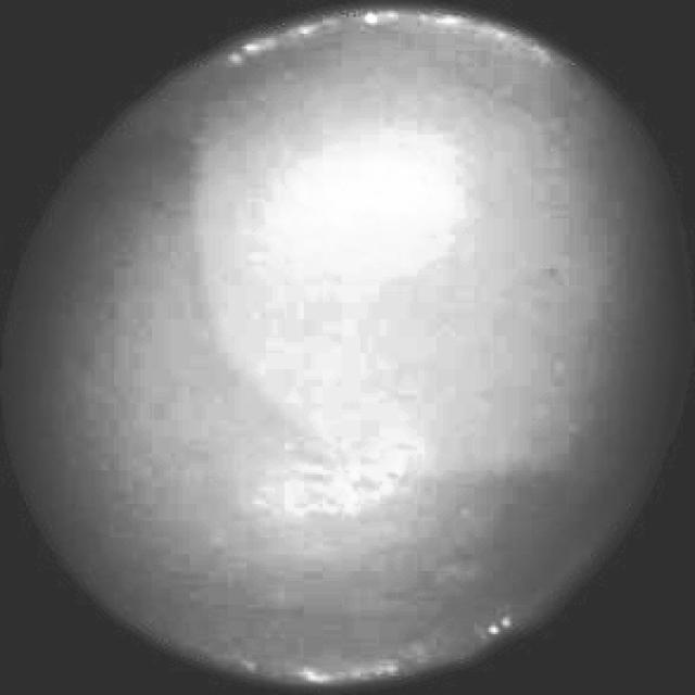 Soy Test - Roboflow Universe