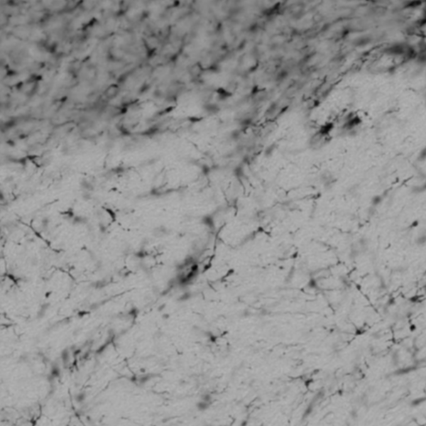 Microglia Object Detection Dataset by Cell Segmentation