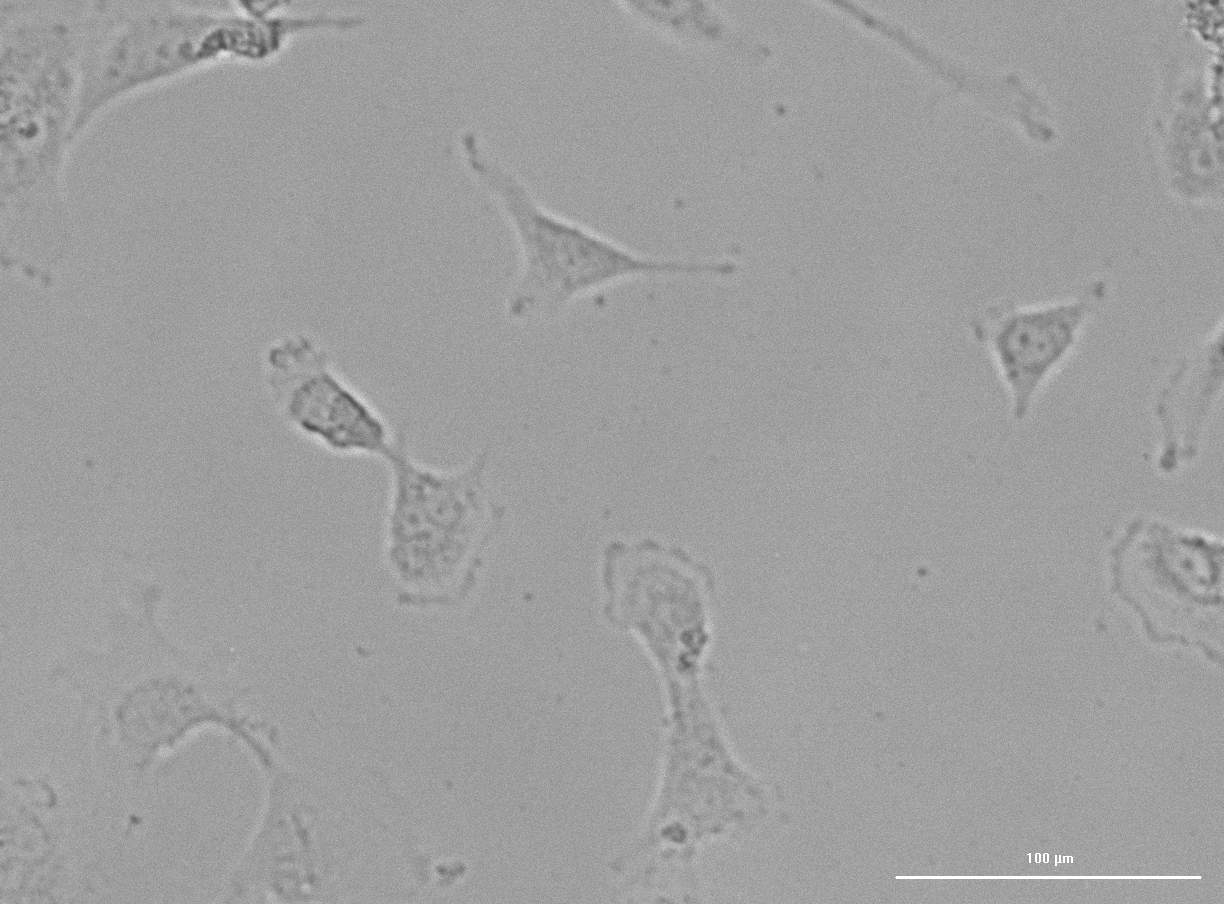 Astrocyte+cancer cell Instance Segmentation Dataset by Cell Segmentation