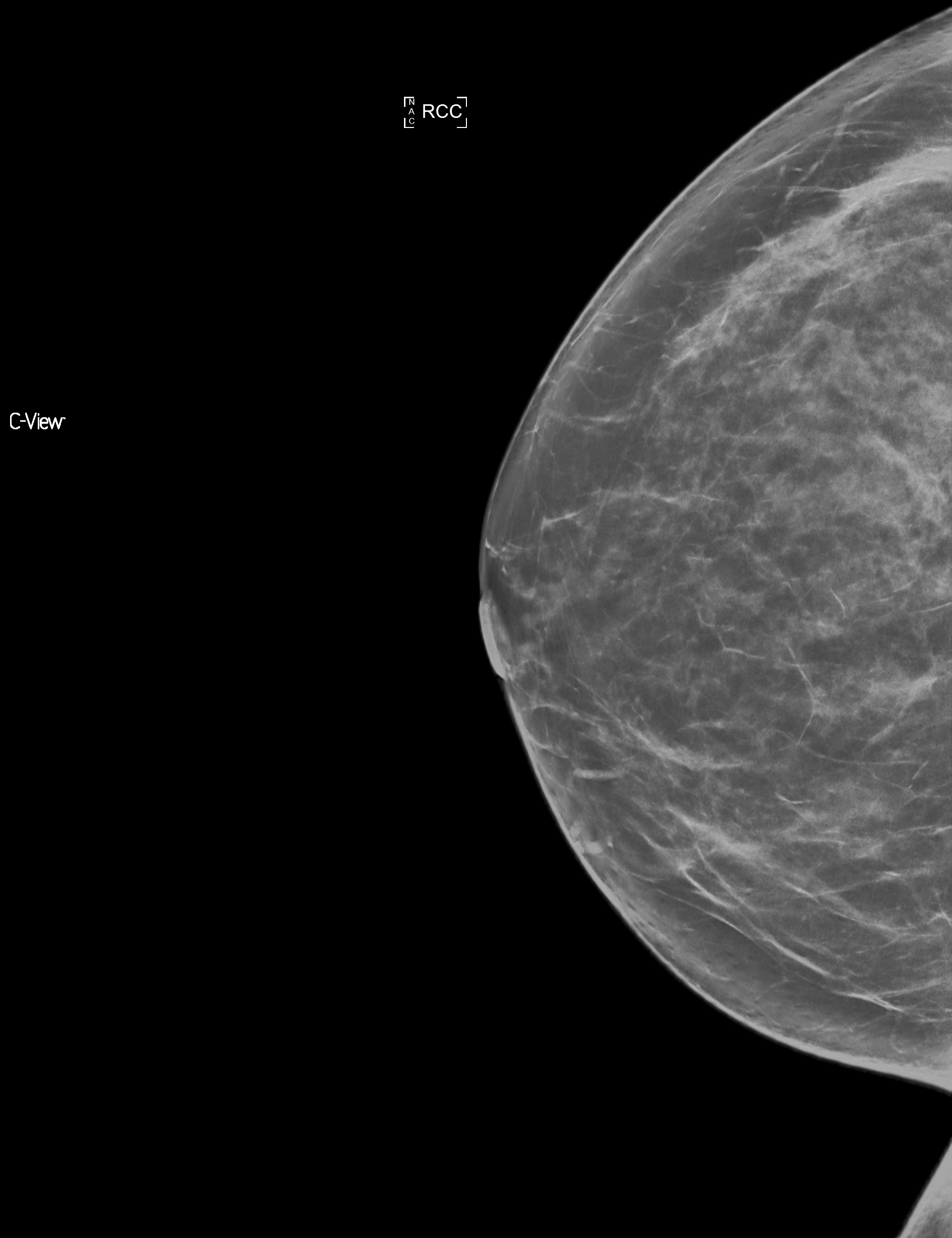 MT Object Detection Dataset and Pre-Trained Model by VM1